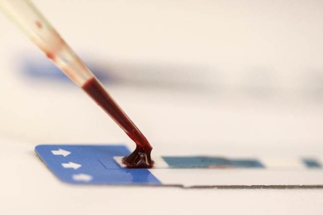 Blood test may diagnose brain cancer five years early: Study - Life ...