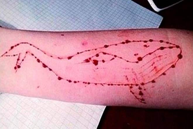 Blue Whale challenge: 2 teens hospitalised; monitoring committee set up ...