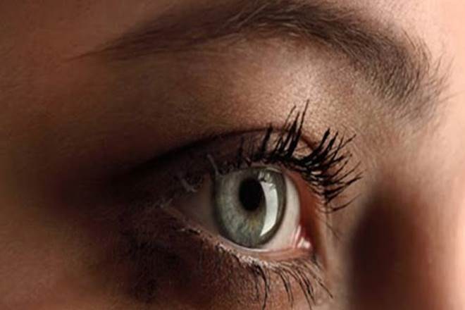 US woman found with eye worm previously known only in cattle - World ...