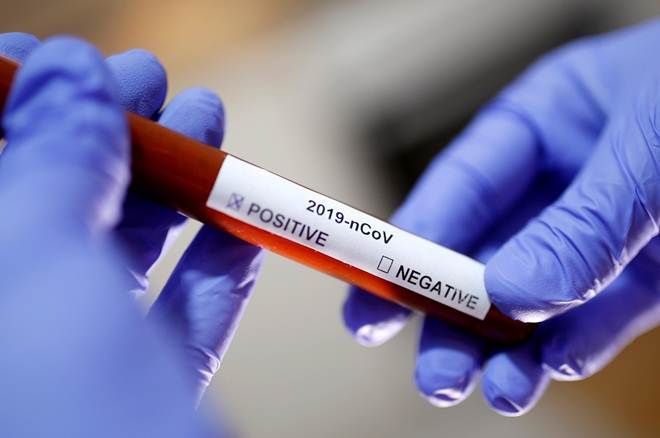 Supreme Court’s order on corona testing is wrong - Opinion News | The ...