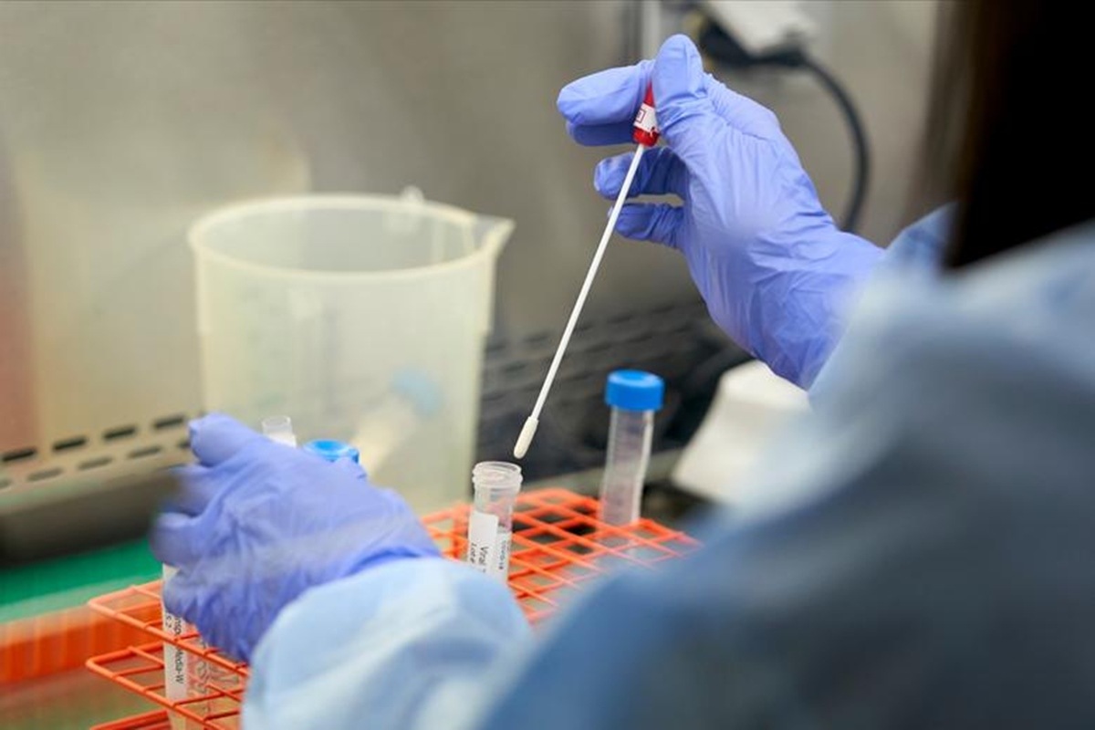 Coronavirus update: New lab testing procedure for detection of ...