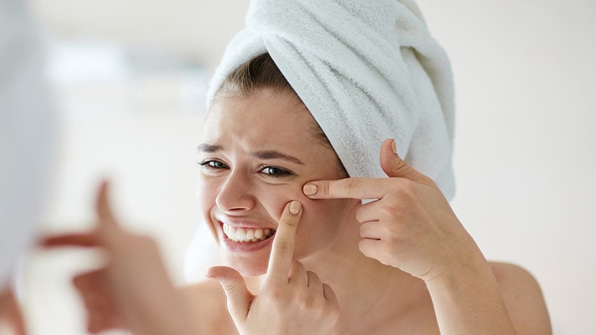 What is Backne and Maskne? How to prevent or get rid of it - Lifestyle ...