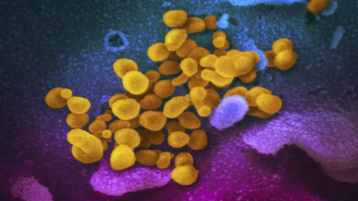 US study finds 1 in 10 get long COVID after omicron, starts identifying ...