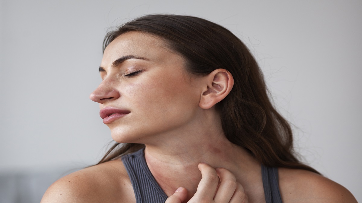 Dermatitis is not just skin-deep: A common skin condition, it can be ...