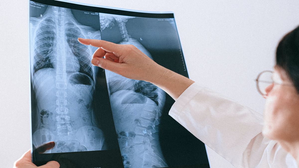What are popcorn lungs? Read on to know all about its symptoms, causes ...