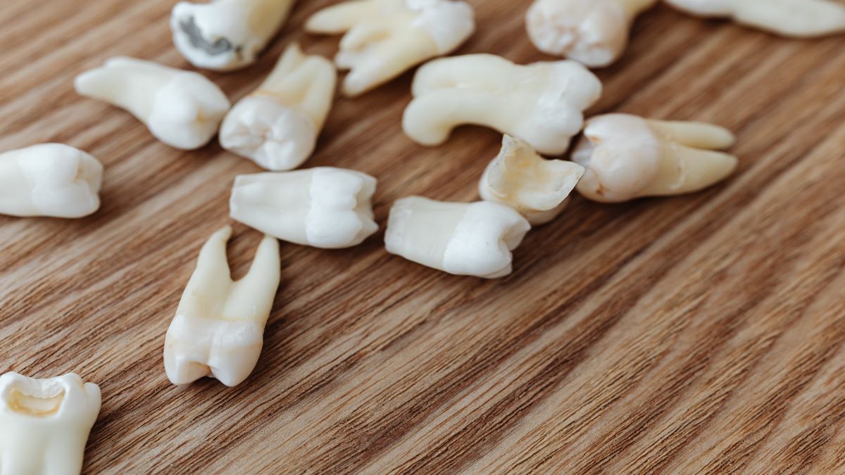 How to deal with broken teeth in children? Know all about it from ...