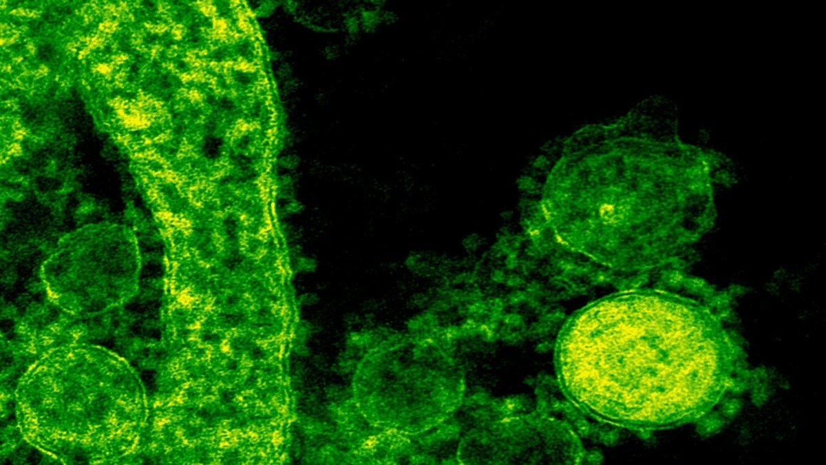 Marburg virus outbreak in Rwanda: 300 cases and 8 deaths reported ...
