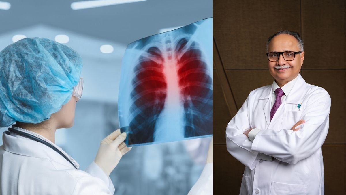 New blood test may spot lung cancer five years early: What patients ...
